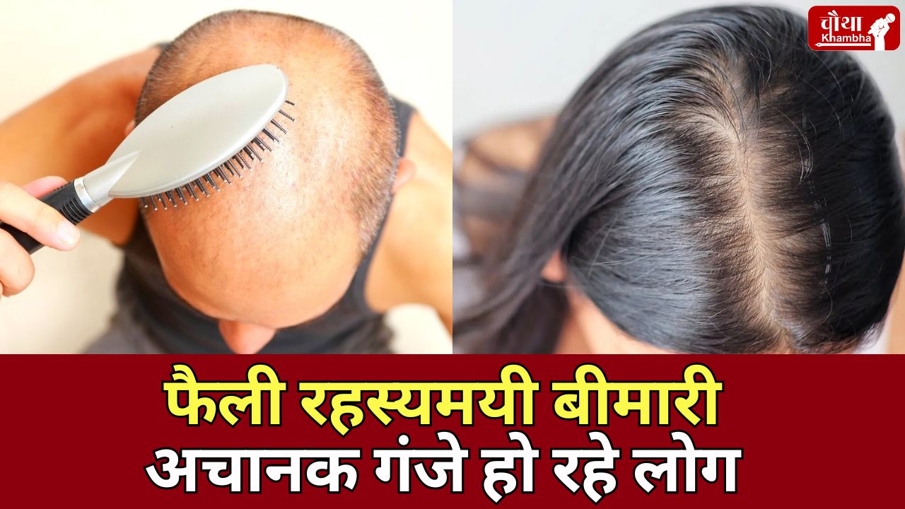 Buldhana Hair loss: विभाग ने सैंपल लेकर जांच के लिए भेजा